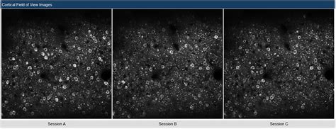 Data Visual Coding Allen Brain Observatory Allen Brain Map Community Forum