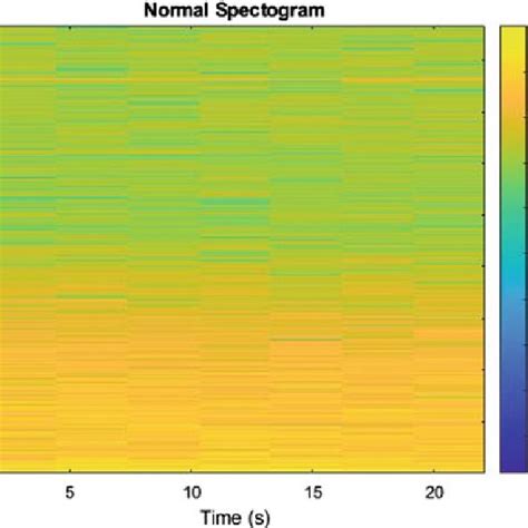 Spectrogram Images In Normal People Download Scientific Diagram