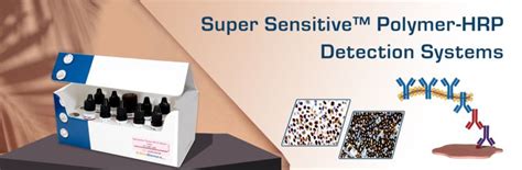 Victoria Miller On Linkedin Biogenex Detectionsystem Ihc