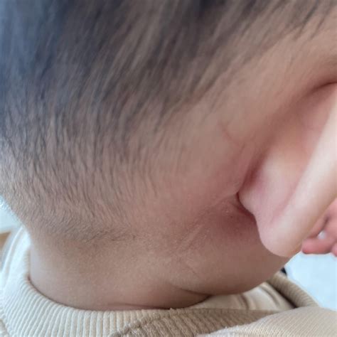 아기 열꽃 두드러기 수딩젤 크림 저흰 어니스트맘 써요 네이버 블로그