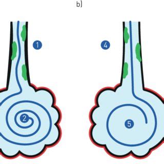 A Factors Influencing The Measurement Of Diffusing Capacity Of The