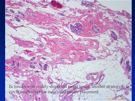 Ppt Requirements For Good Tissue Microarray Tma Results Powerpoint Presentation Id 4513355