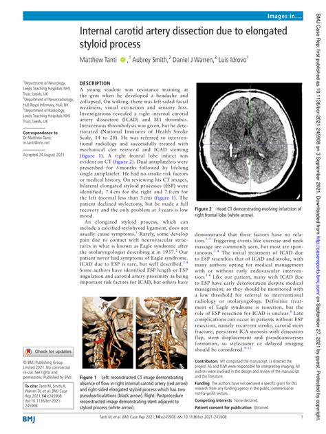 Pdf Internal Carotid Artery Dissection Due To Elongated Styloid Process