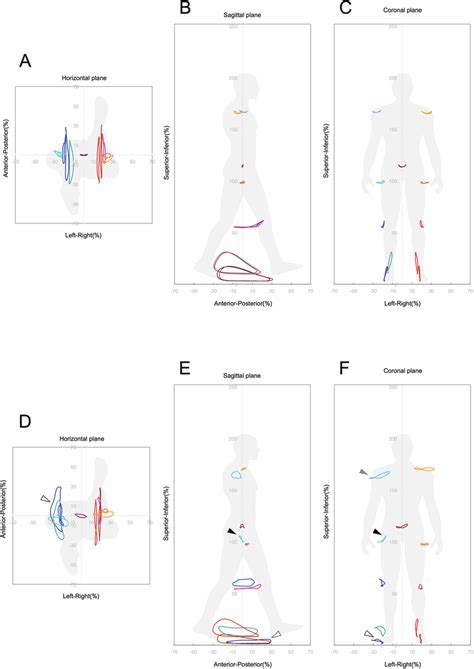 Representative Holistic Lissajous Overviews Of Gait Patterns In Stroke