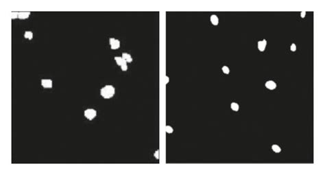 Comparison Of Nucleus Image Segmentation Results A Original Image Download Scientific