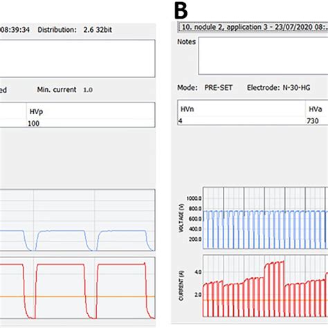 Representative Graph Of Voltages And Currents Of Delivered Electric
