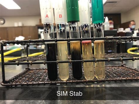 Microbiology Lab Practical Final Part2 Flashcards Quizlet