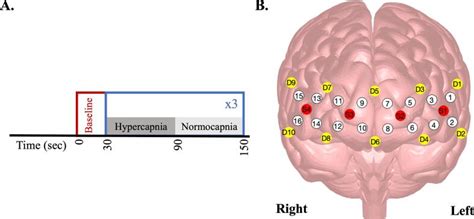Differences In Time Frequency Characteristics Between Healthy Controls