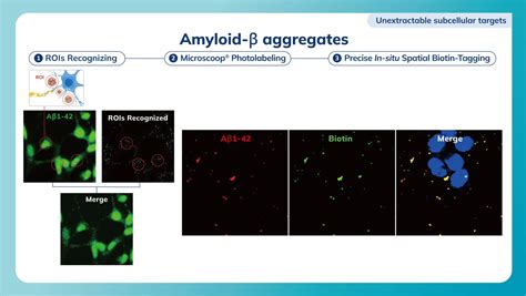 Datasets Amyloid Beta Aggregates Syncell Inc