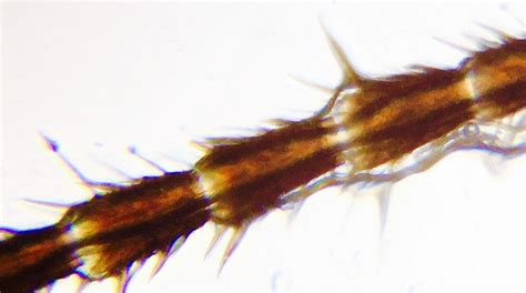 Why Roaches Are Extremely Hard To Catch By Uhandy Microscope Medium