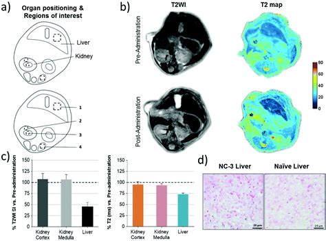 PLGA protein nanocarriers with tailor-made fluorescence/MRI/PET imaging modalities - Nanoscale ...