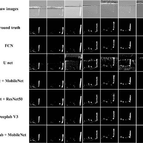 Illustration Of The Semantic Segmentation Results On The X Ray Images Download Scientific