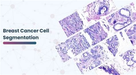 Breast Cancer Cell Segmentation Dataset Download Now