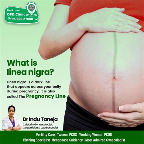 Dr What Is Linea Nigra Linea Nigra Is The Dark Vertical Line That Appears On The Belly