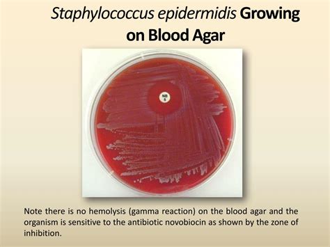 Ppt Isolation And Identification Of Staphylococci Powerpoint Presentation Id 3098162