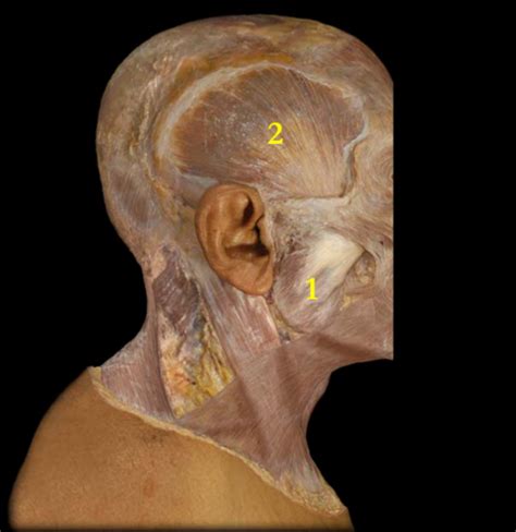 infratemporal fossa flashcards quizlet