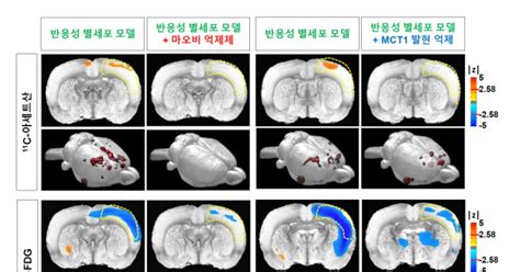 알츠하이머 뇌세포 변화 영상화 성공