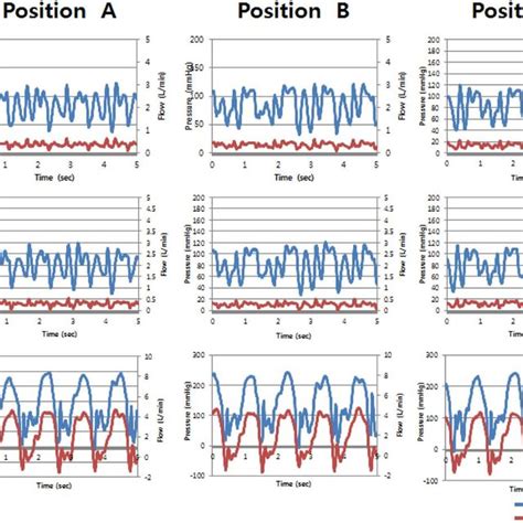 Pressure And Flow Waveforms Were Measured Simultaneously For 60 Seconds Download Scientific