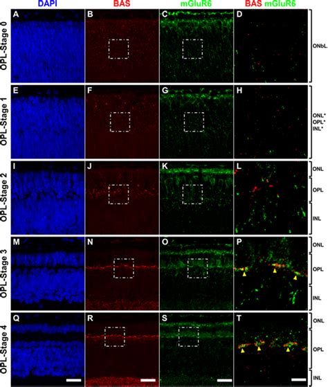 Characterization And Staging Of Outer Plexiform Layer Development In Human Retina And Retinal