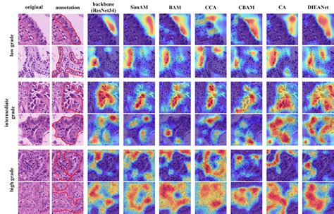 gradient weighted class activation map for each model when resnet34 is