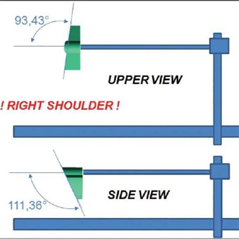 Walch Type 2b Glenoid Exhibiting Biconcave Glenoid With Posterior Wear