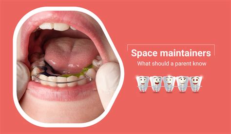 Dental Space Maintainer Cost In India At Michael Doxey Blog