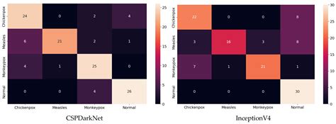 Diagnostics Free Full Text Detection Of Monkeypox Disease From Human Skin Images With A