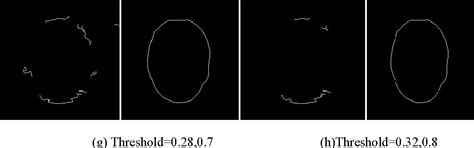 Figure 3 From Ultrasound Images Edge Detection Using Anisotropic Diffusion In Canny Edge