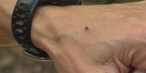 Powassan Virus Disease Confirmed In Sharon Abc6