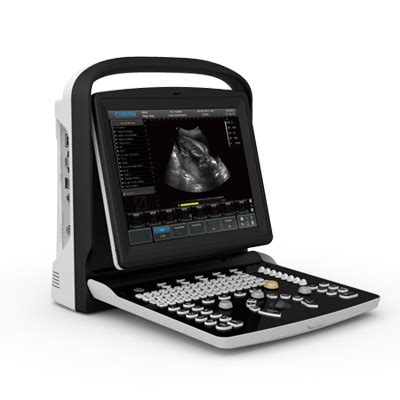 Chison Ultrasound Machines Redstone Healthcare