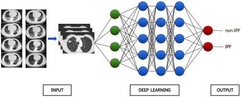 Recent Advances Of Artificial Intelligence Applications In Interstitial Lung Diseases