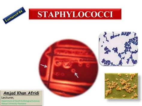 Staphylococcus 256712602pdf Staphylococcus 256712602pdf