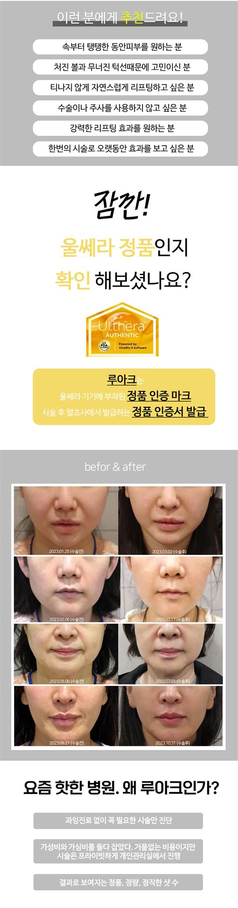 루아크 울쎄라 By 루아크성형외과의원 강남언니 1등 성형수술and피부시술 정보앱