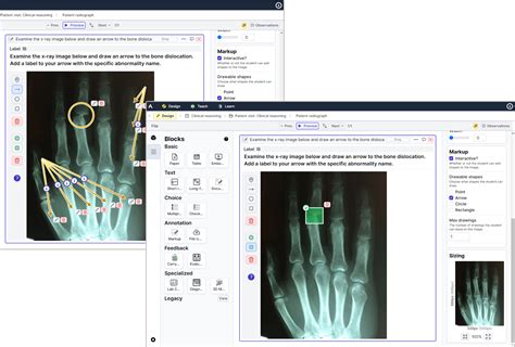 Allele Markup Feature