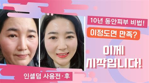 인셀덤 처음 사용하는 방법 궁금하면 인셀덤 얼굴 원하신다면 주목 Youtube
