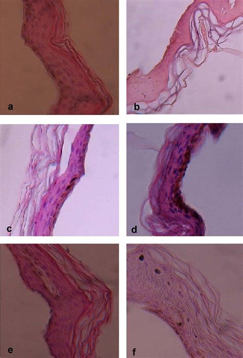 Photomicrographs Of Sce Treated With Free Ccb And Modified Cyds And Download Scientific Diagram