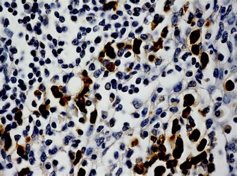 Lambda Probe Biogenex