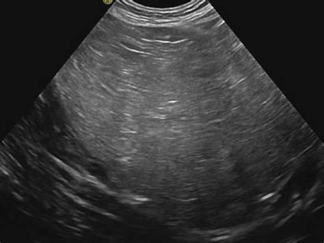 Musculoskeletal Bone Muscle Nerves And Other Soft Tissues 75 Soft