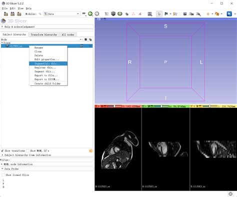 Github Shine636363cmr4slicer