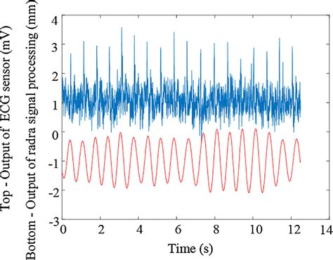 Heart Beat Signal Extracted From Radar Data And Synchronized Ecg Signal Download Scientific