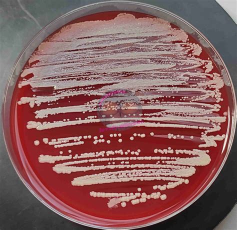 Staphylococcus Saprophyticus
