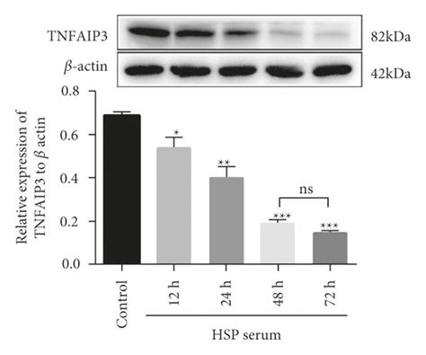 Let 7a Affects Vascular Endothelial Cell Apoptosis By Targeting Tnfaip Download Scientific