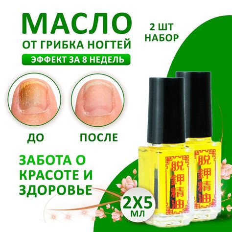 Масло для ногтей средство для лечения грибка и онихолизиса, 2 шт по 5 ...