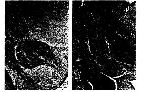 4 Photomicrographs Of Transverse Bodian Stained Section