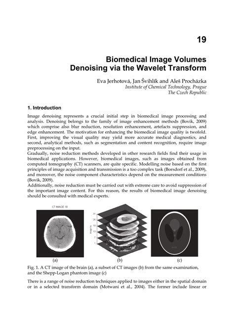 Pdf Biomedical Image Volumes Denoising Via The Wavelet Transform