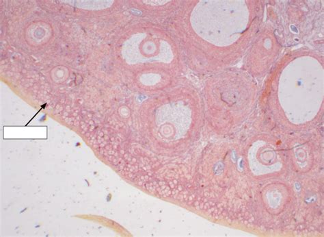 Female Reproductive System Histology Flashcards Quizlet