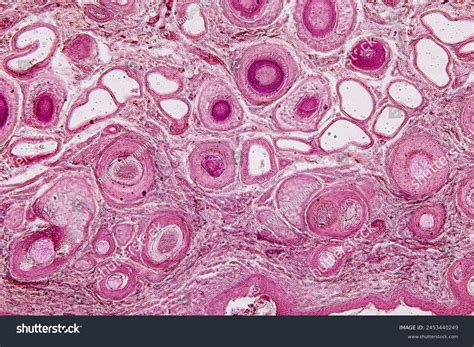 Human Bone Cells Under Microscope Histology Human Compact Bone Tissue
