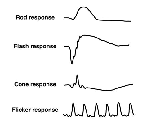 How To Read And Interpret Erg A Practical Guide To Electroretinography