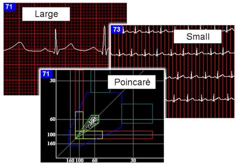 an arduino ecg device with an integrated display arduino blog