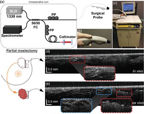 Third Generation Intraoperative Portable Oct System And Handheld Probe Download Scientific